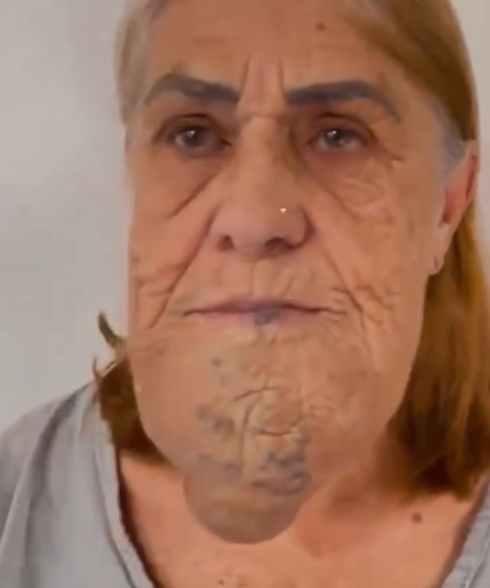 Hon förändrade hela sitt liv … en operation som förändrade allt. - Love ...